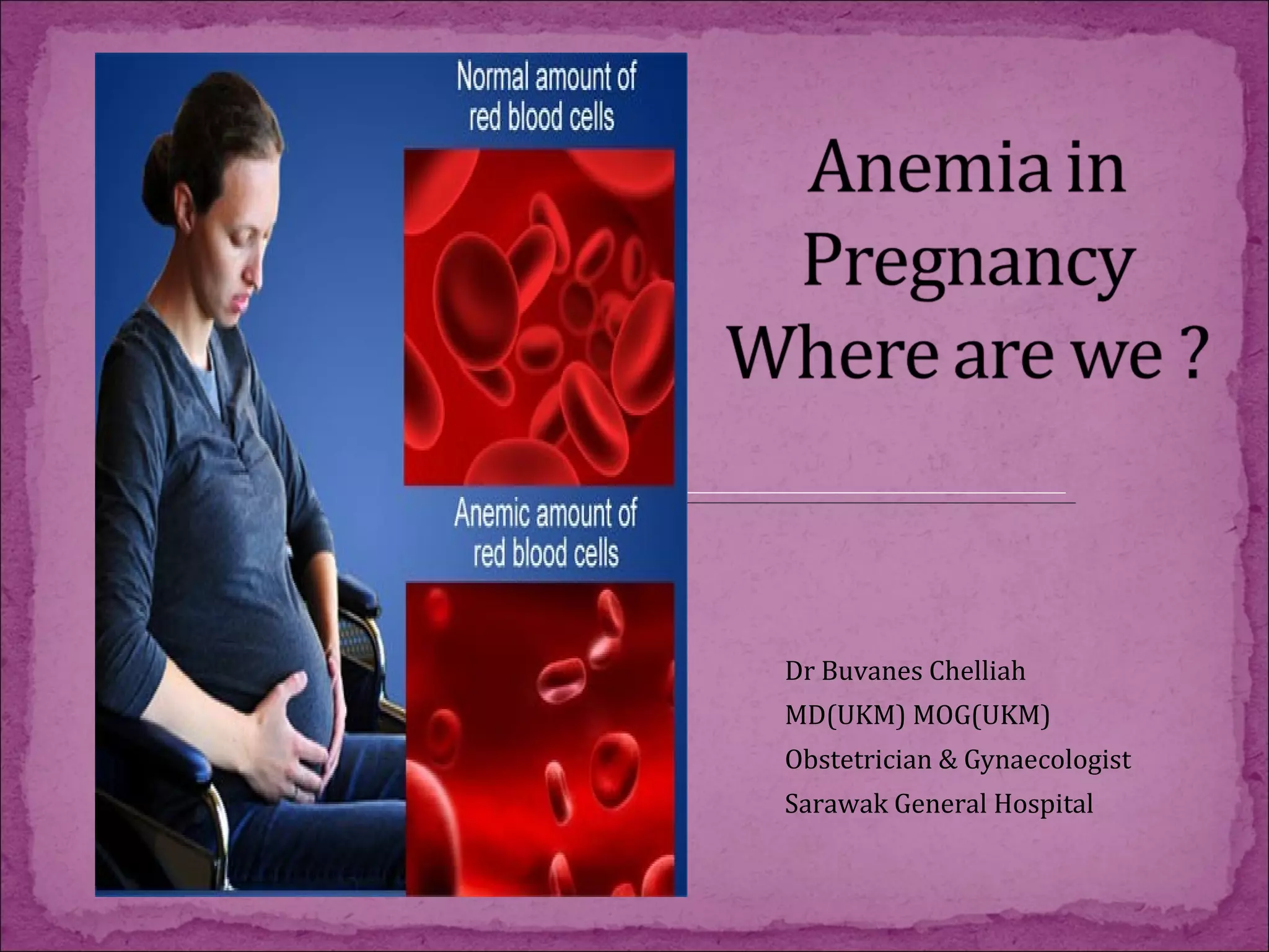 Anemia in pregnancy | PPT