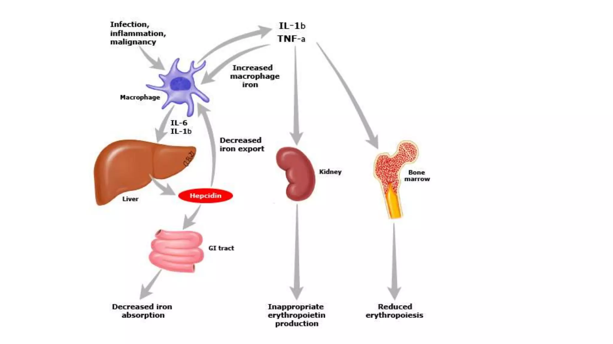 Anemia in sle pregnant | PPT