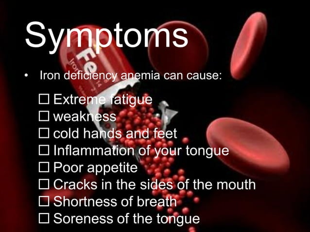 Anemia (iron deficiency anemia) | PPT