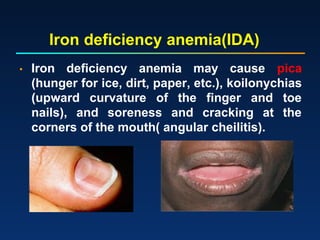 Anemia and types of anemias Lecture.docx