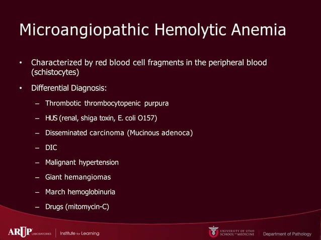 Anemia Lecture for the MLT students.pptx | Blood Disorders | Diseases ...