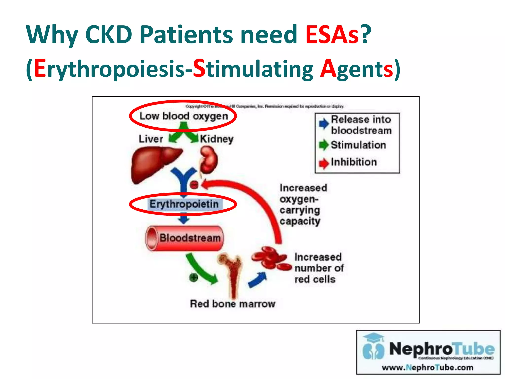 Anemia management in CKD (ESA Therapy) - Dr. Gawad | PPT