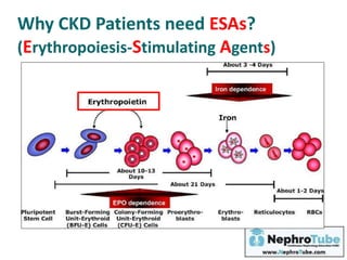 Anemia management in CKD (ESA Therapy) - Dr. Gawad | PPT