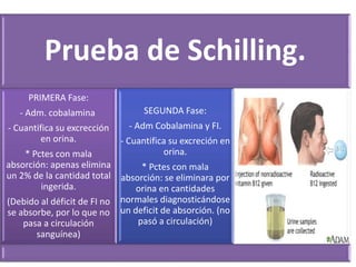 Anemia megaloblastica | PPTX