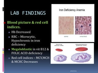 anemia mlt.pptx