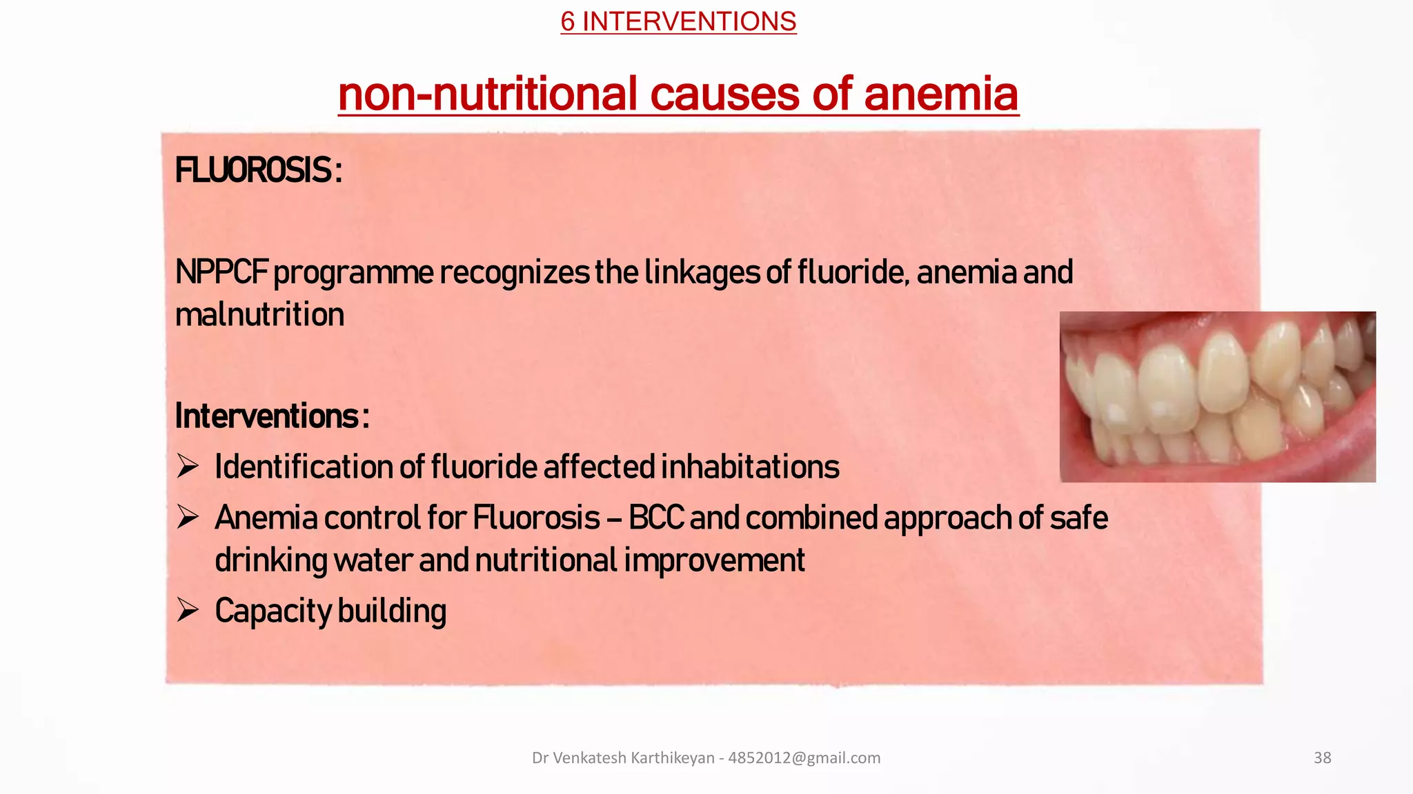 Anemia Mukt Bharat - 6x6x6 strategy | PPTX