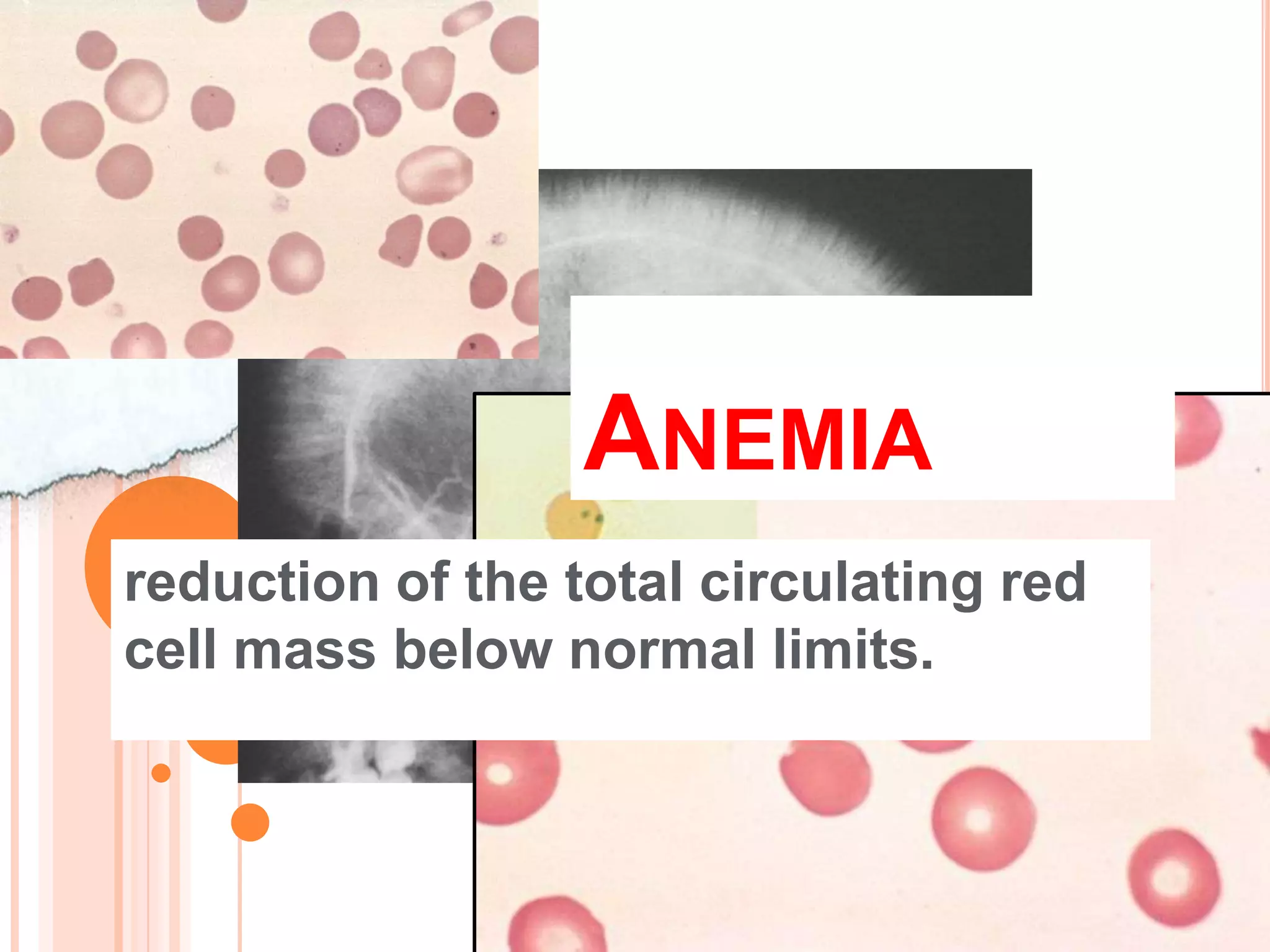 Anemia overview | PPTX