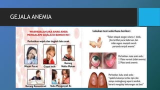 Anemia pada remaja putri | PPTX