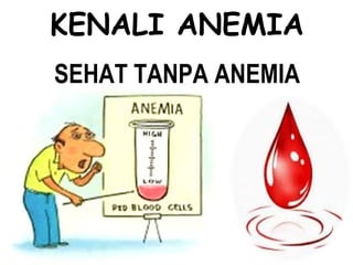 Anemia pada rematri | PPT