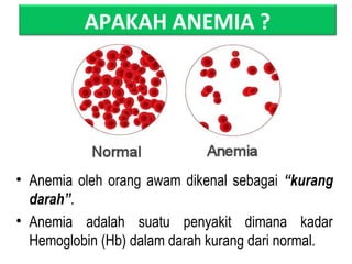 Anemia pada rematri | PPT