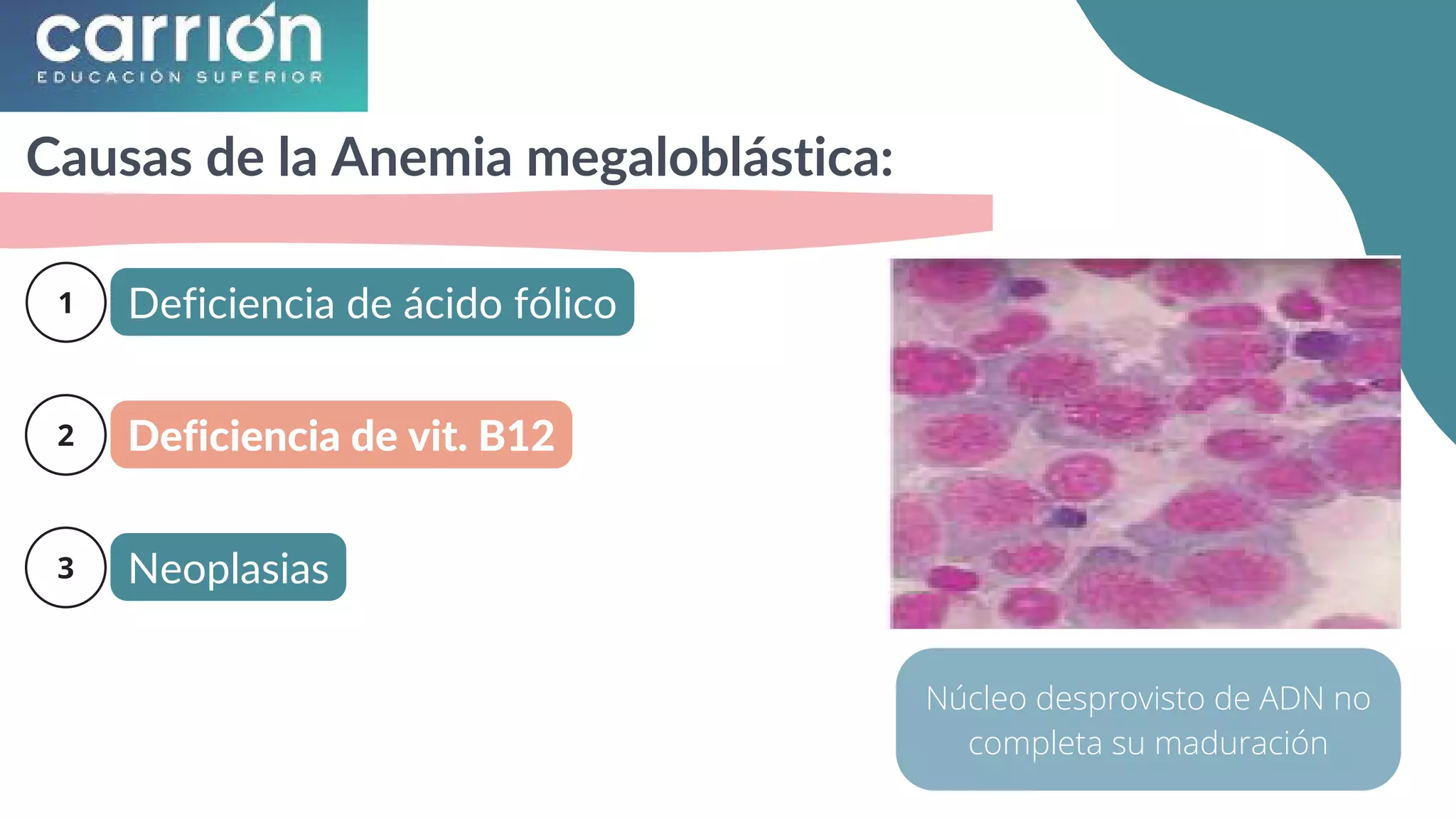 Anemia por déficit de vitamina b12 y Ácido fólico | PDF