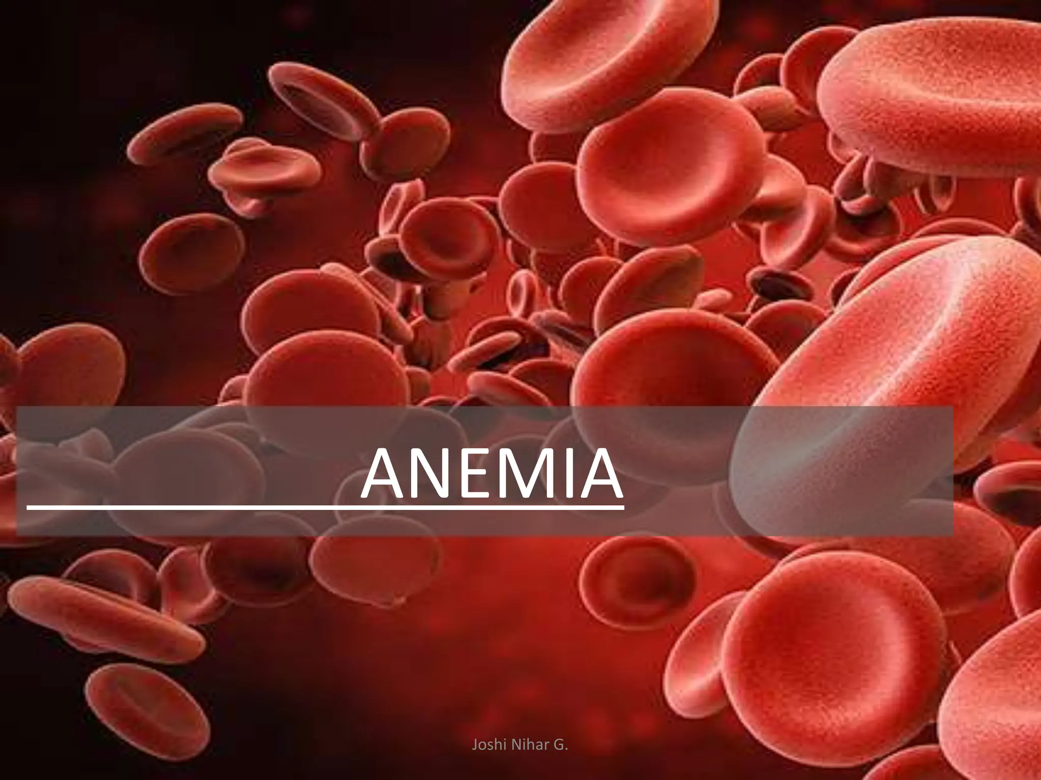 ANEMIA Final Year Medicine Whole Topic Covered In Brief | PPTX