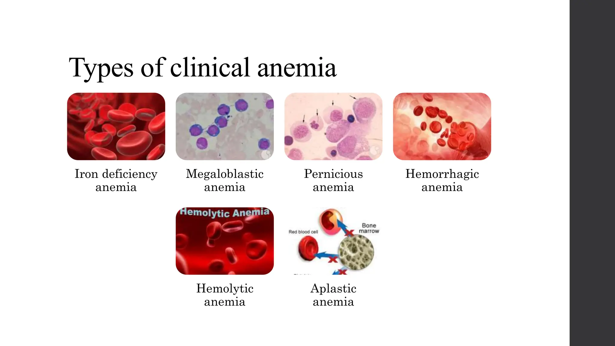 ANEMIA PPT-1.pptx ...................... | PPTX