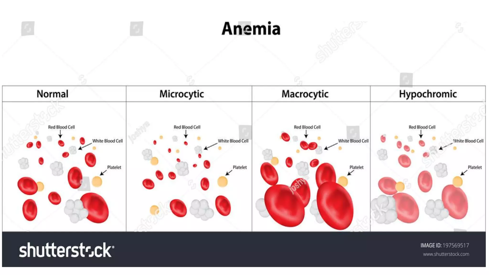 Anemia ppt | PPTX
