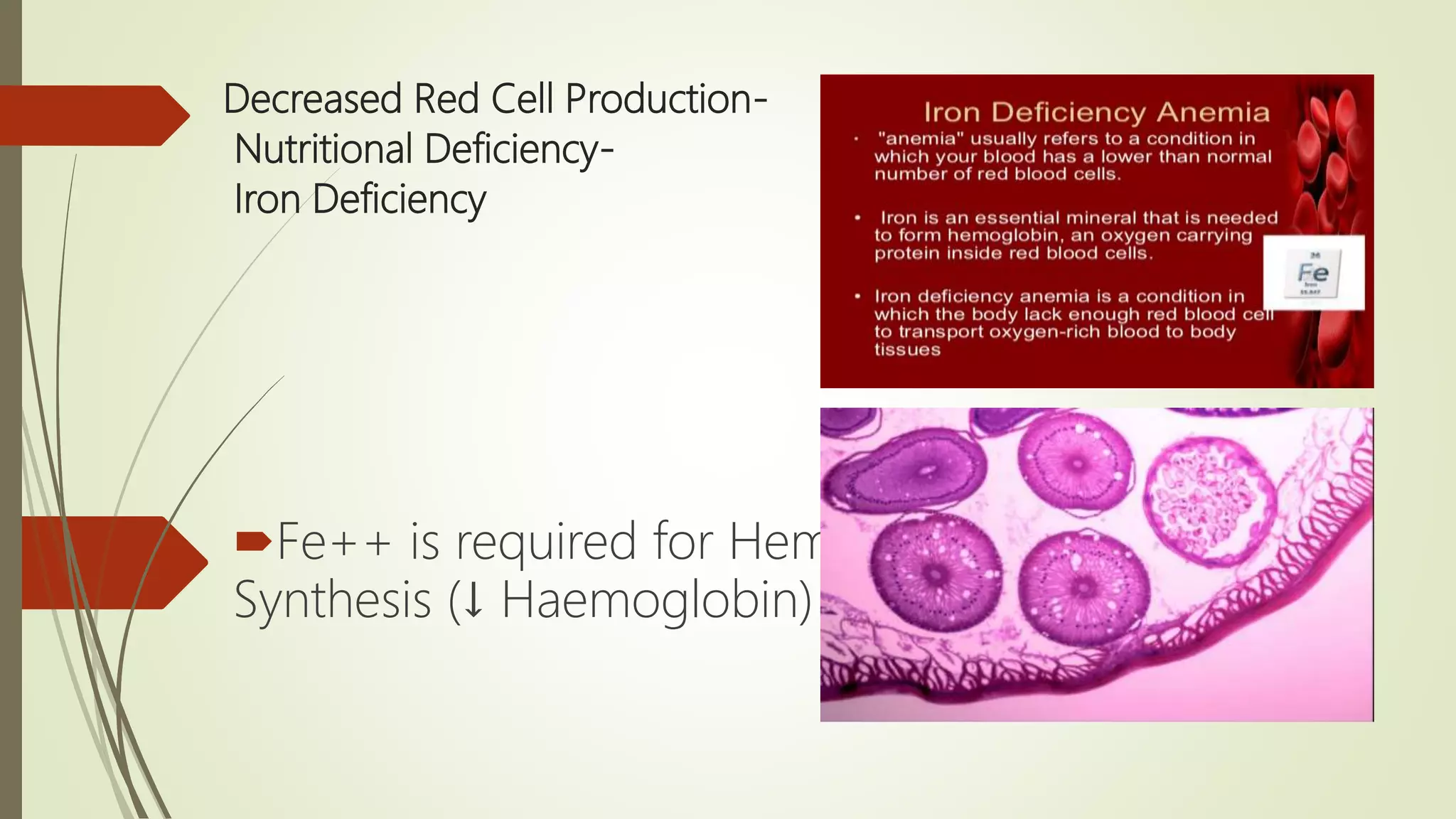 ANEMIA PPT.pptx