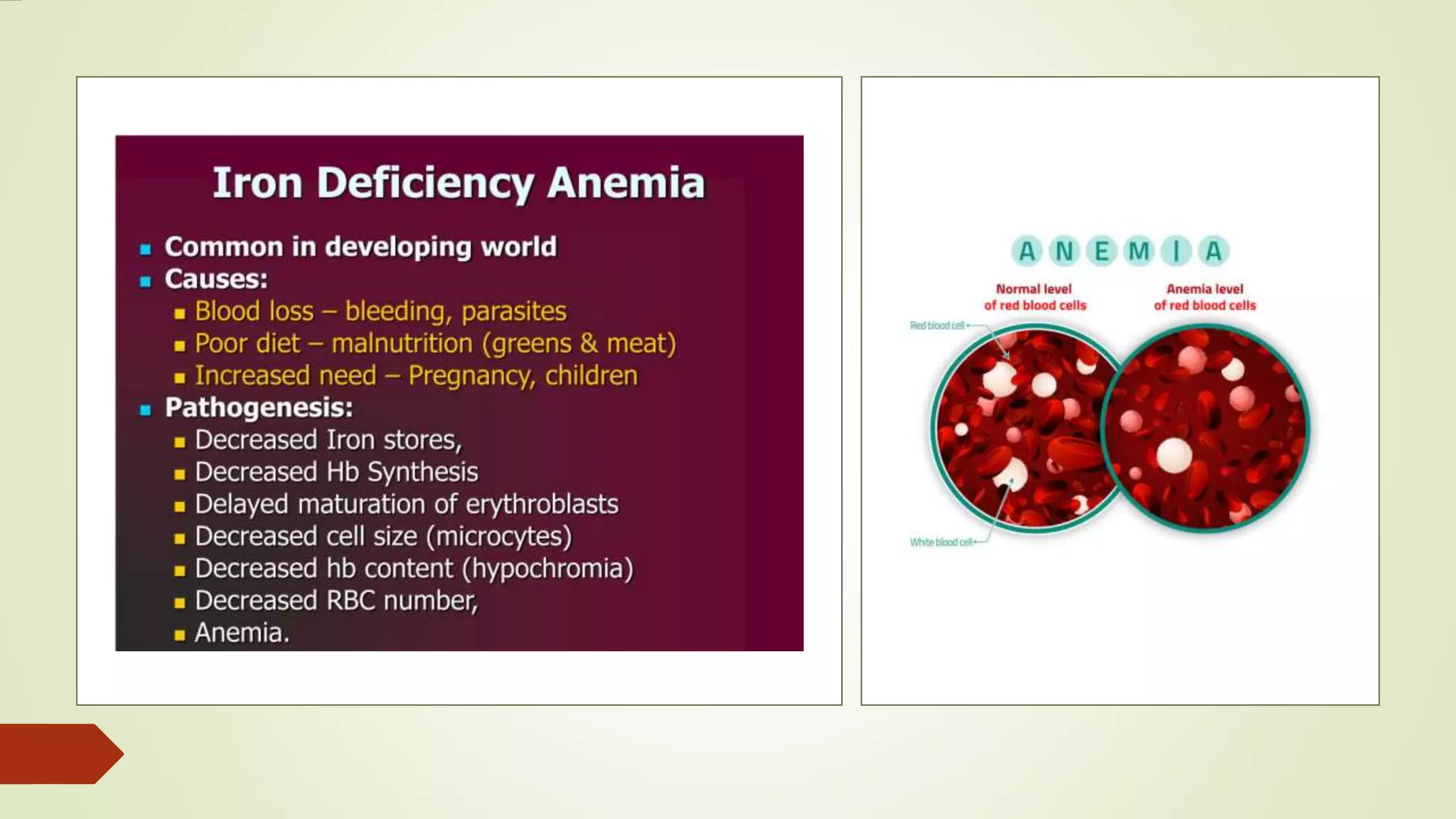 ANEMIA PPT.pptx | Blood Disorders | Diseases and Conditions