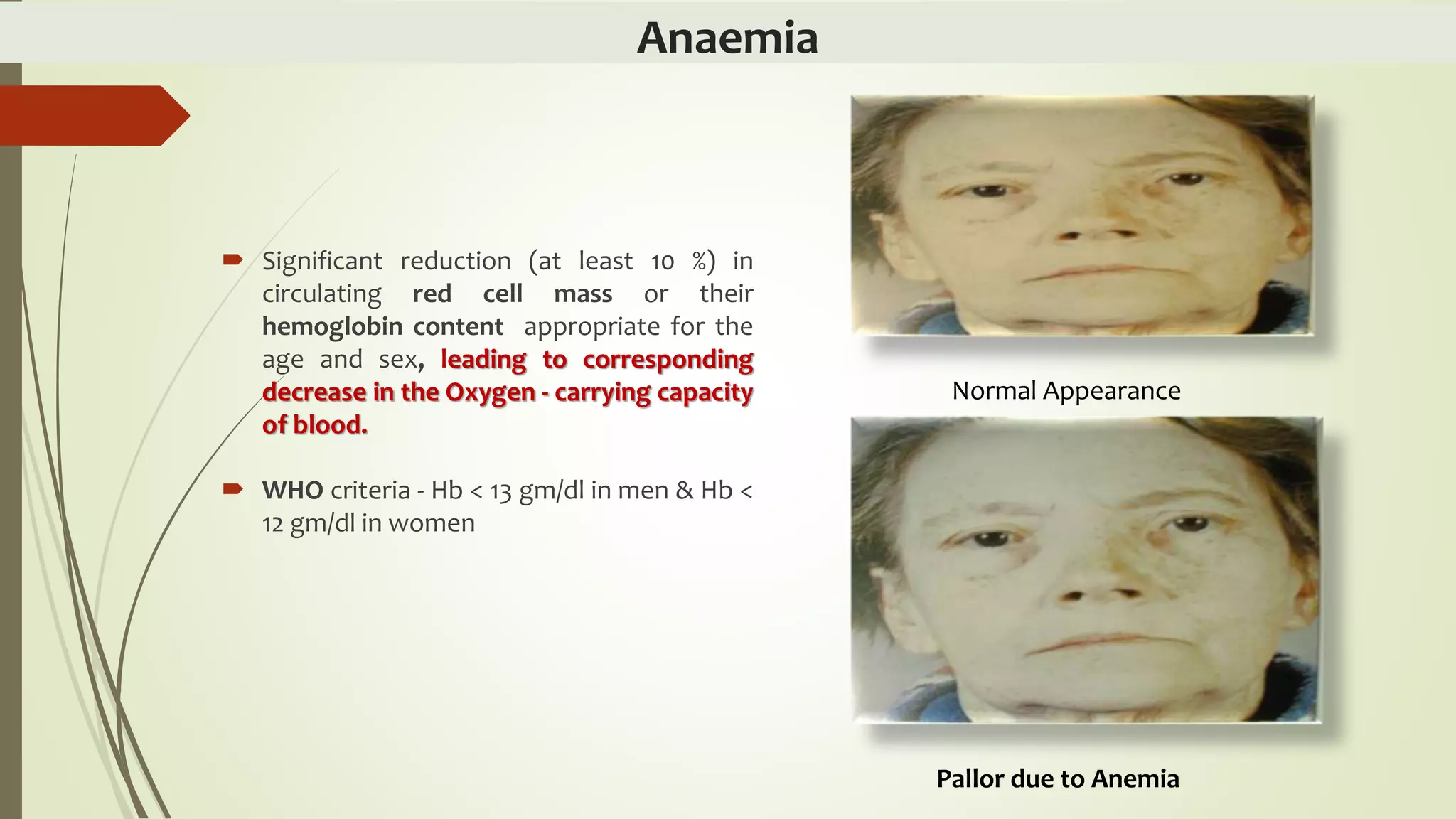 ANEMIA PPT.pptx