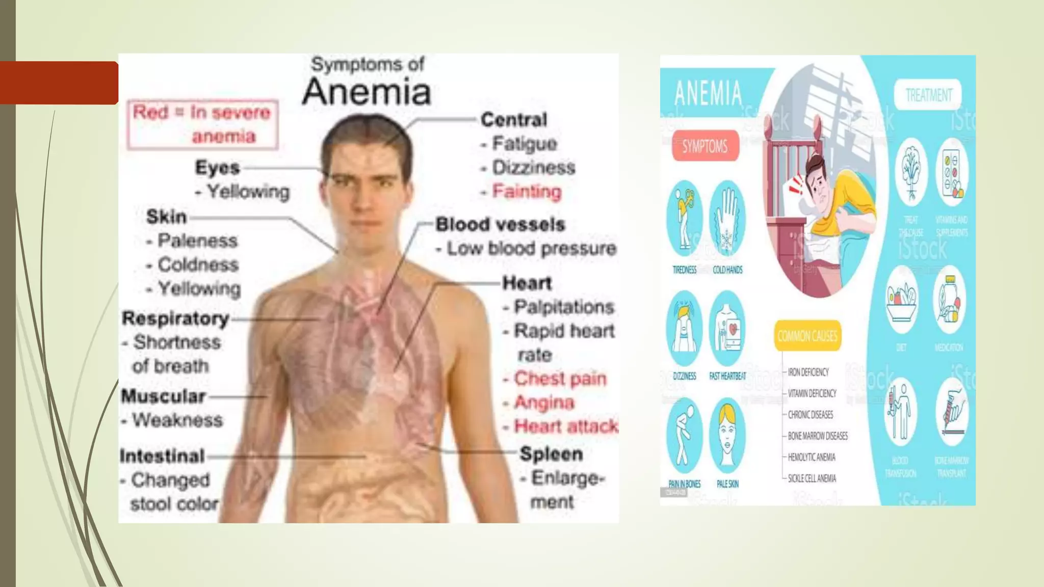 ANEMIA PPT.pptx