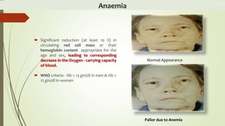 ANEMIA PPT.pptx | Blood Disorders | Diseases and Conditions