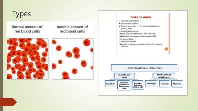 ANEMIA PPT.pptx | Blood Disorders | Diseases and Conditions