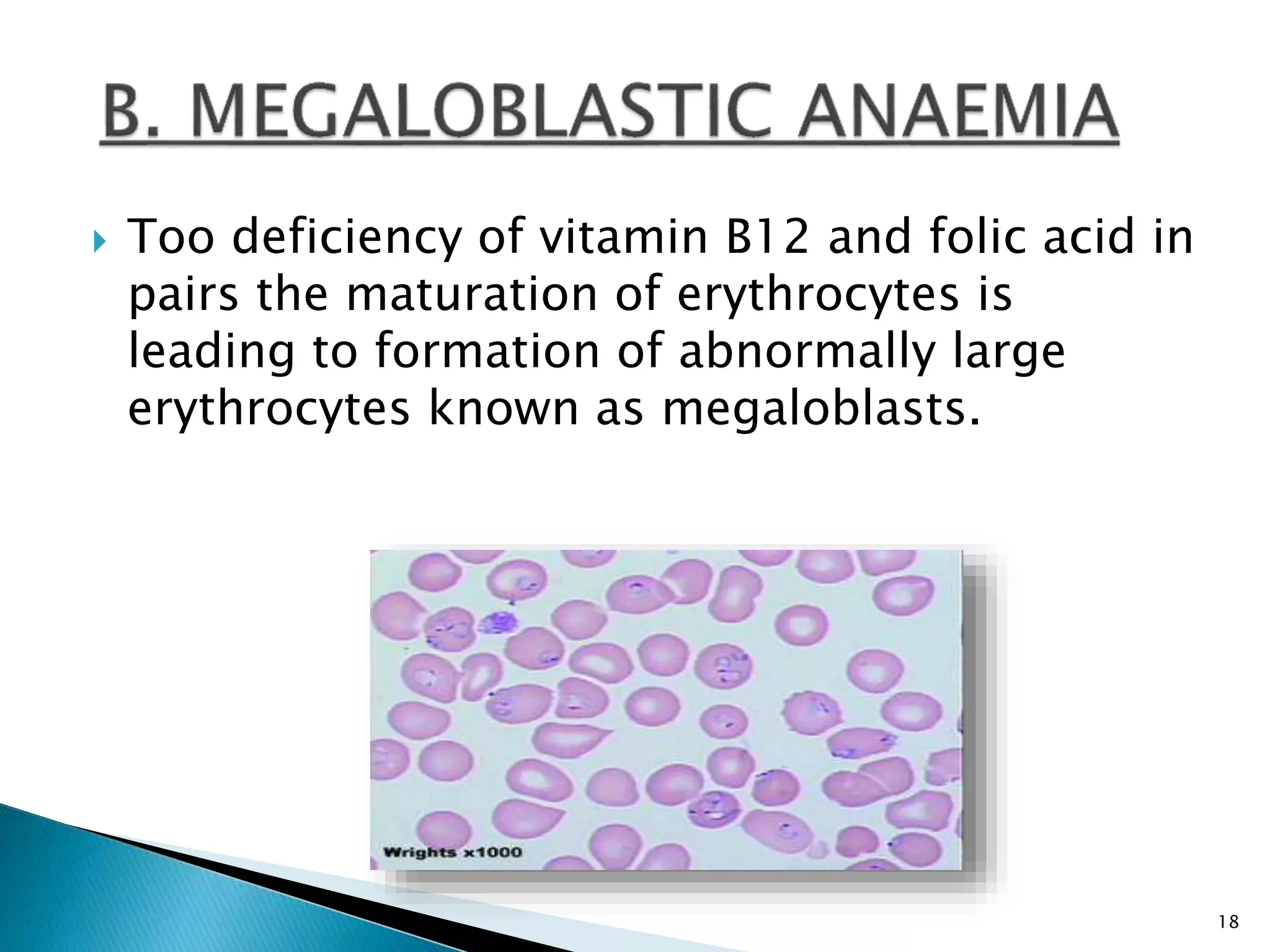 ANEMIA PPT.pptx | Blood Disorders | Diseases and Conditions