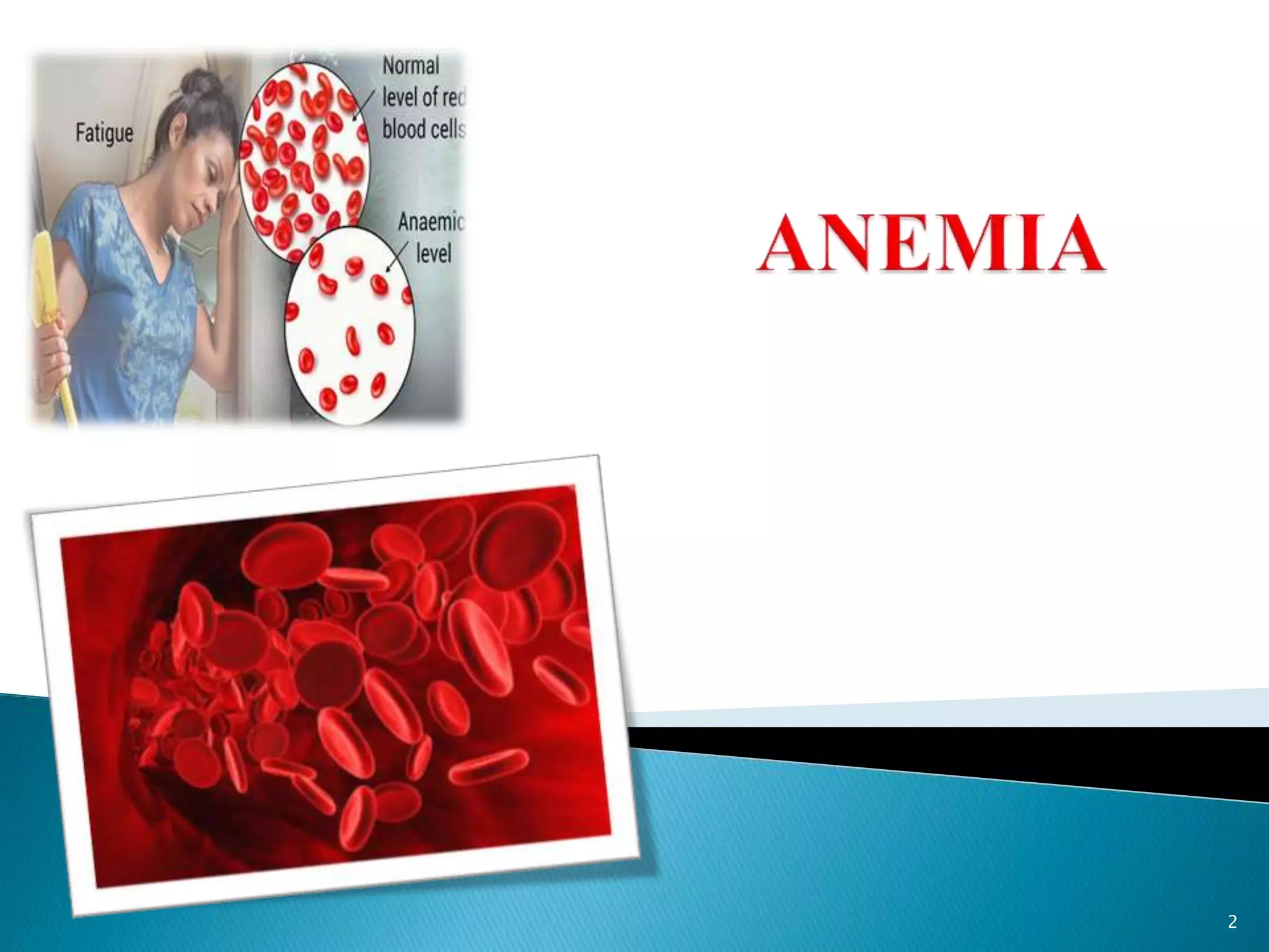 ANEMIA PPT.pptx