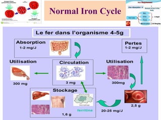 Anemia pregnancy | PPTX