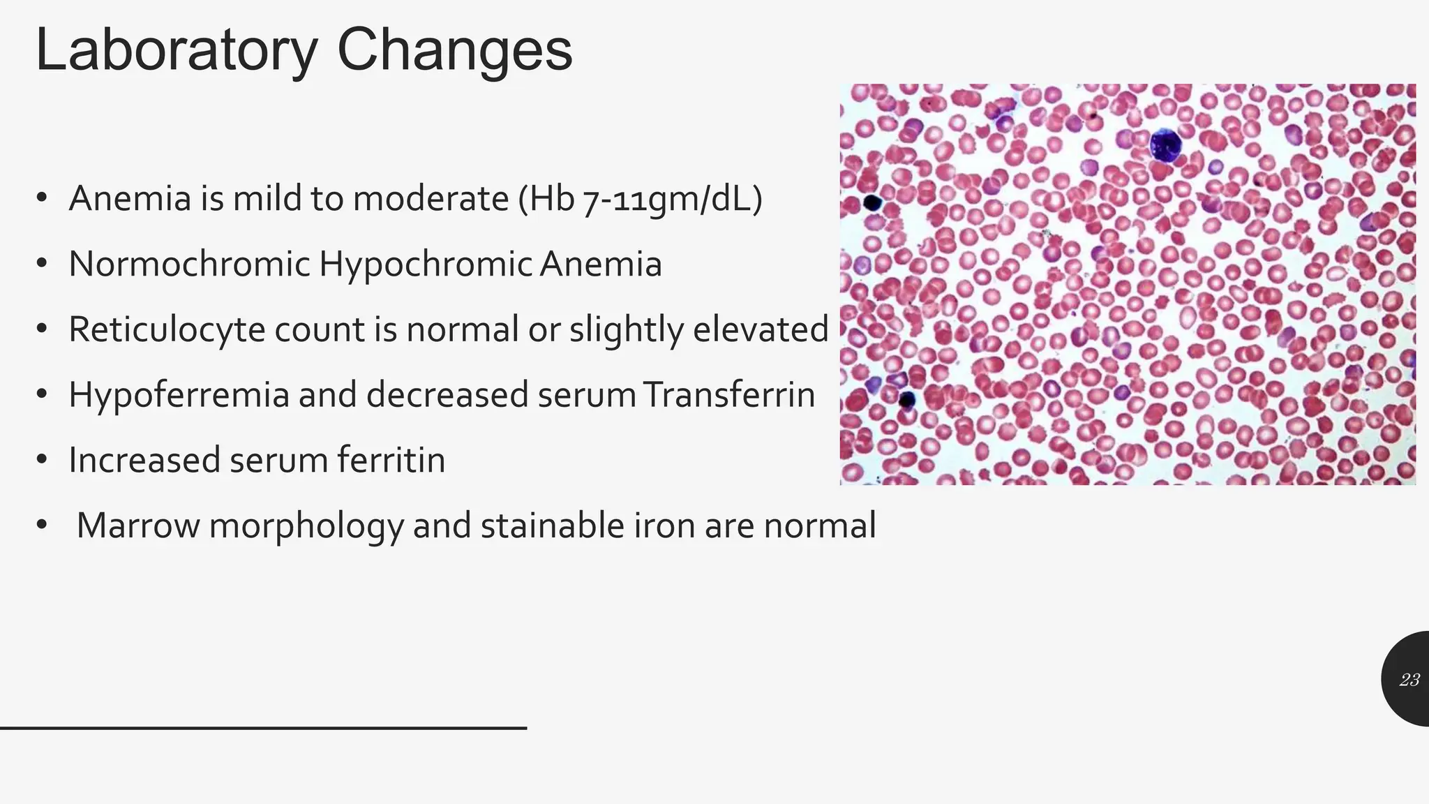 Anemia Profile- modified for study..pptx