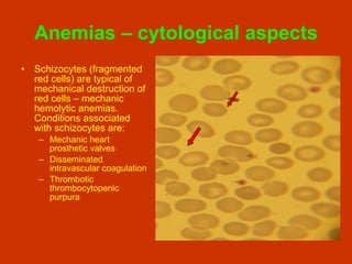 Anemias | PPT