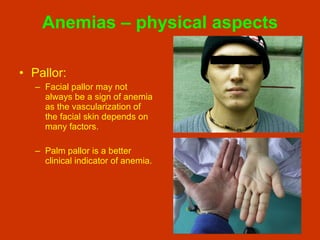 Anemias | PPT