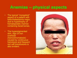 Anemias | PPT