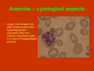 Anemias | PPT