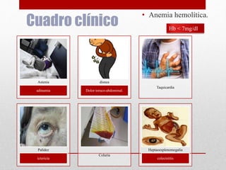 Anemias | PPTX