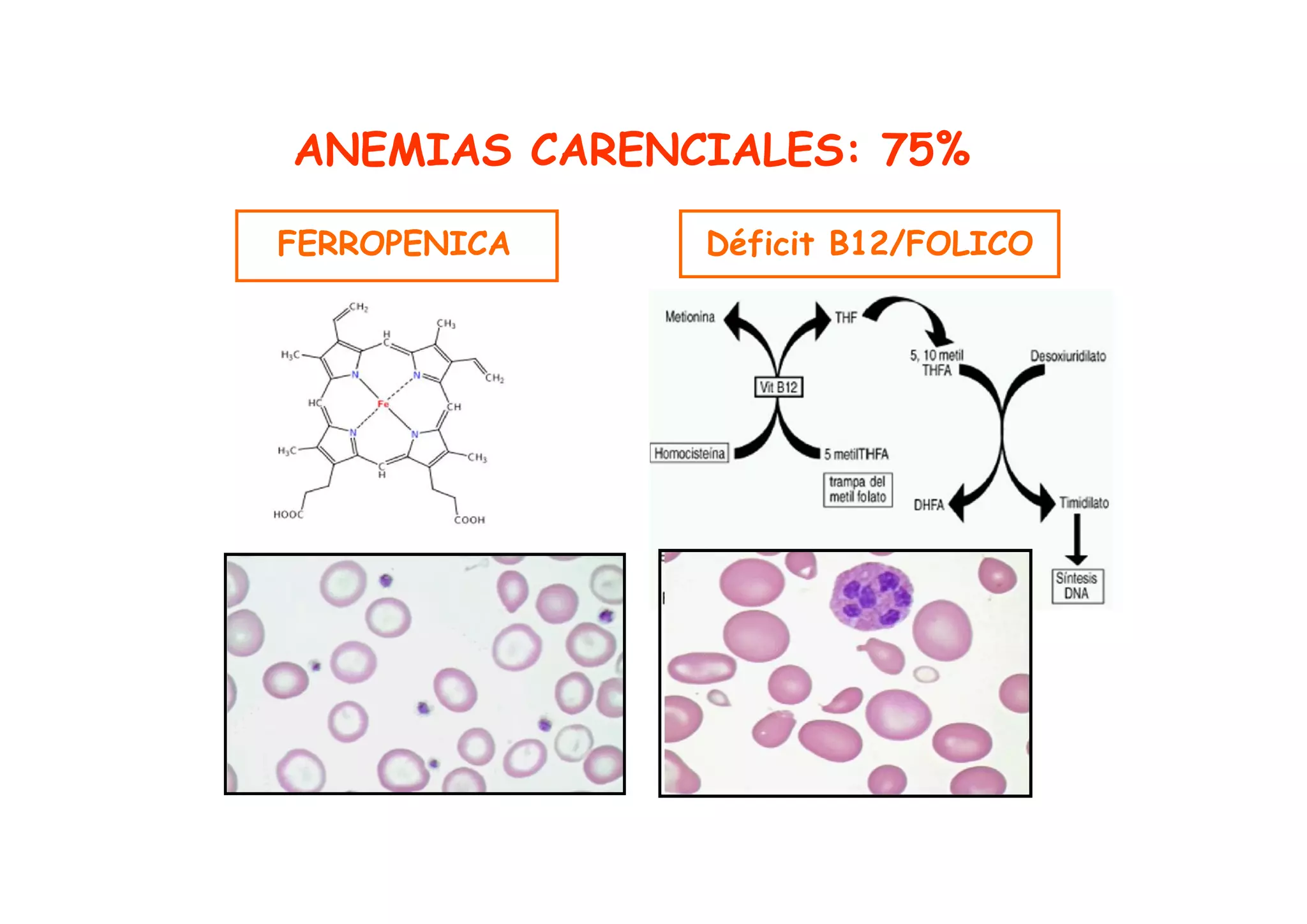 Anemias. Diagnóstico diferencial y tratamiento | PPT
