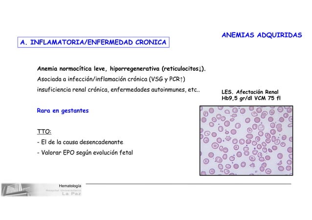 Anemias. Diagnóstico diferencial y tratamiento | PPT