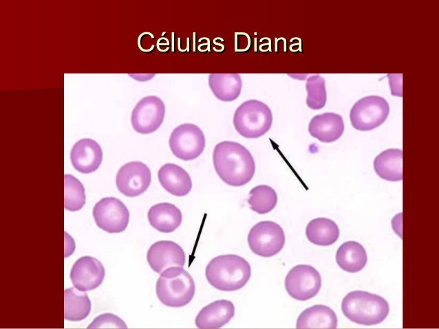 Anemias generalidades