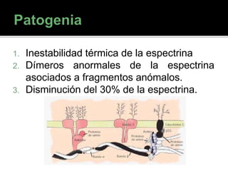 Anemias hemolíticas por defecto de membrana 1 | PPT