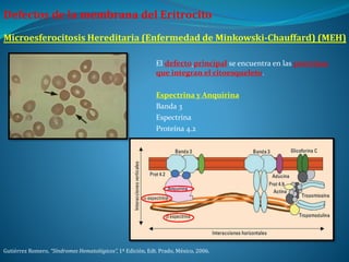 Anemias Hereditarias | PPTX