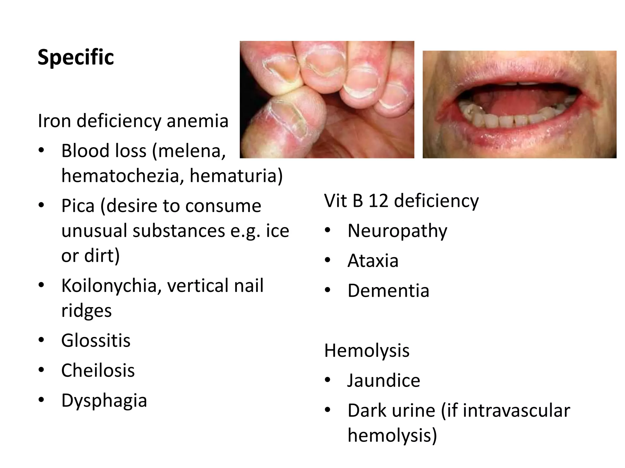 Anemia in elderly | PPTX