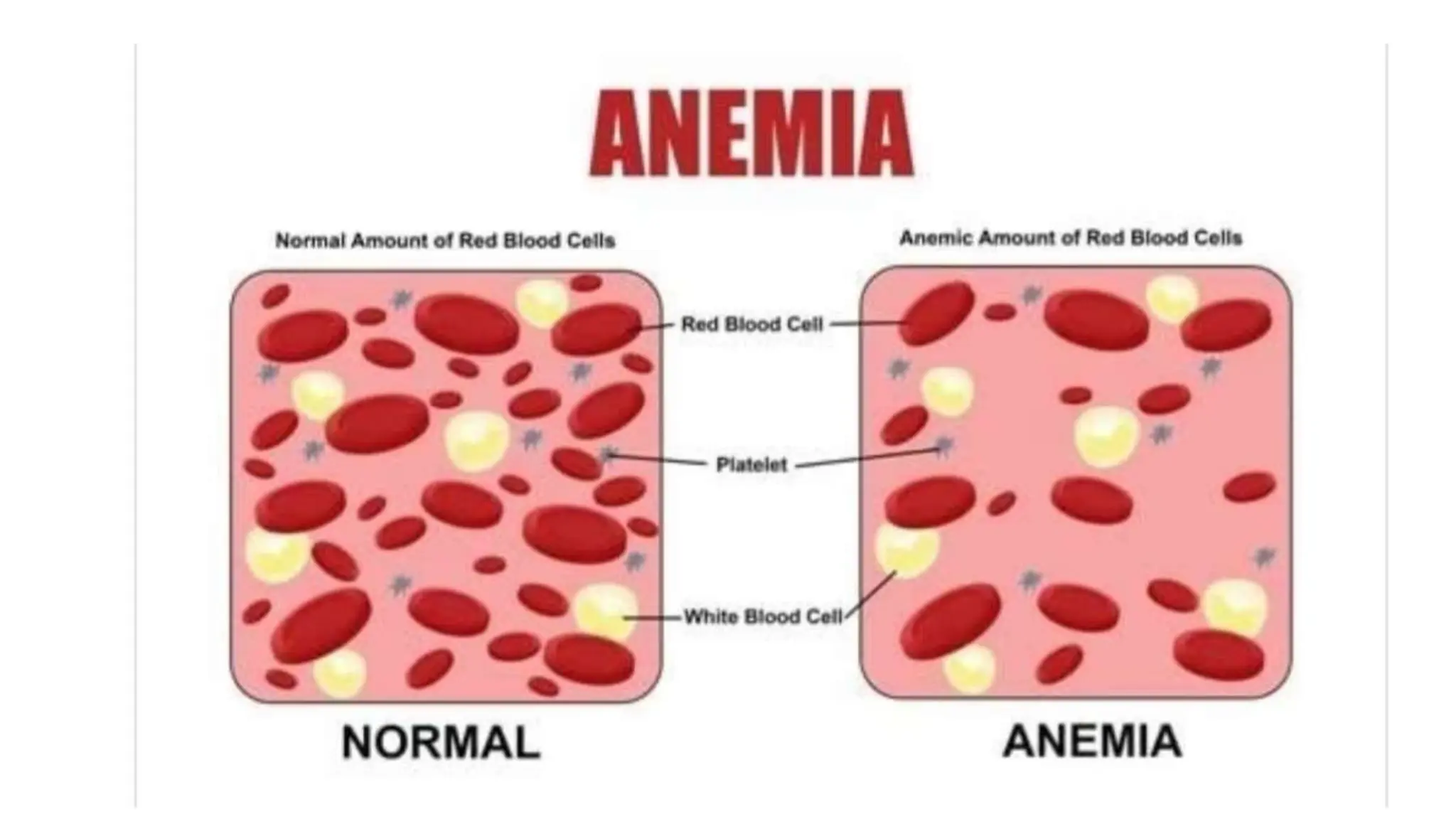 Anemia_ types_clinical significance.pptx