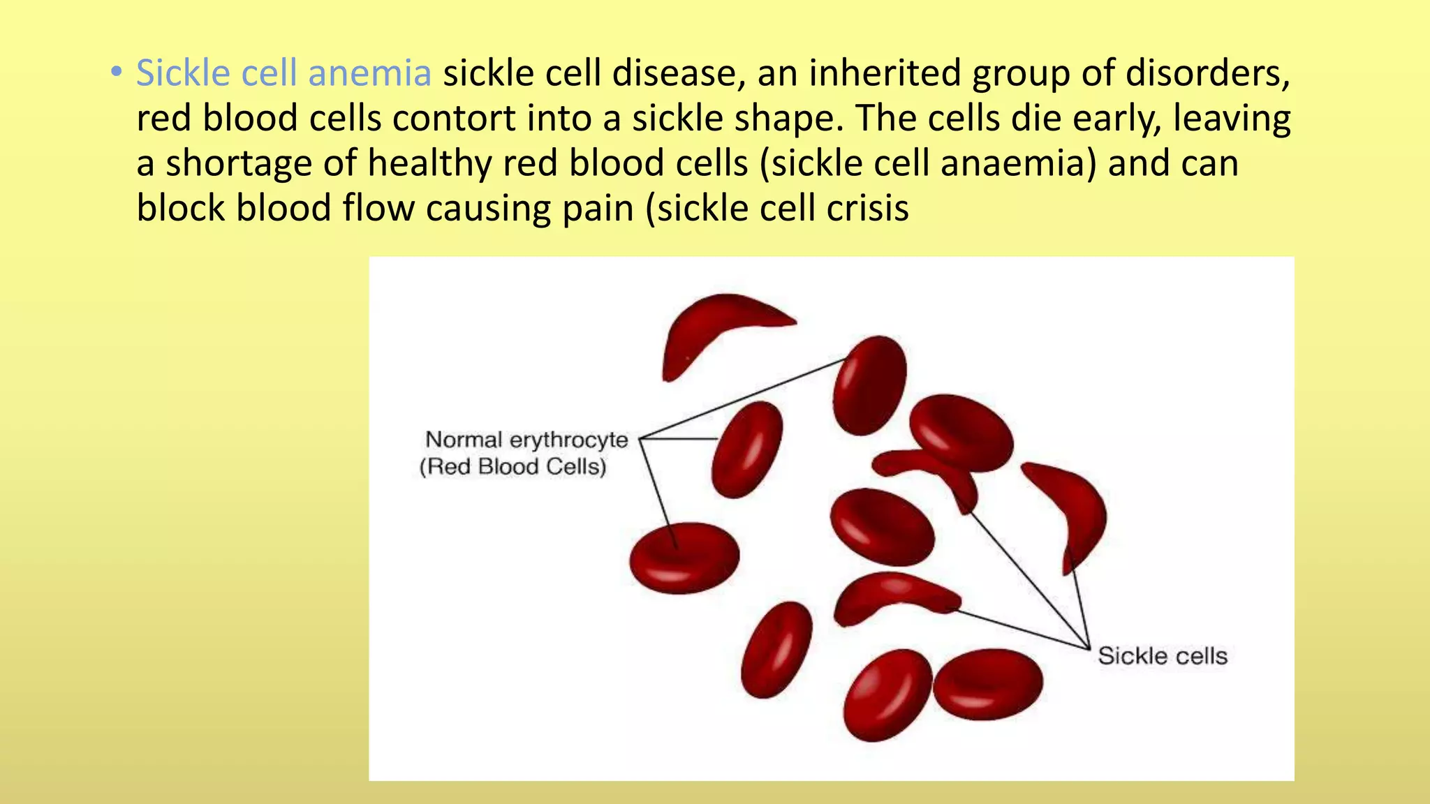 Anemia & types of anemia | PPTX