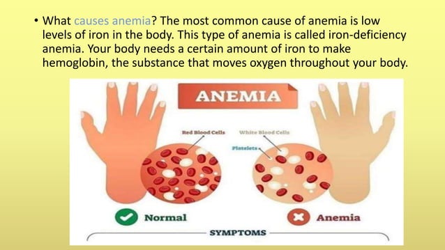 Anemia & types of anemia | PPT