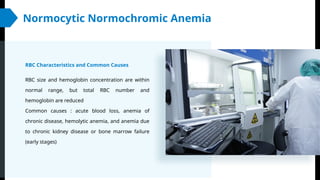 Anemia_ Understanding, Classification, and Management_AI PPT Maker.pptx