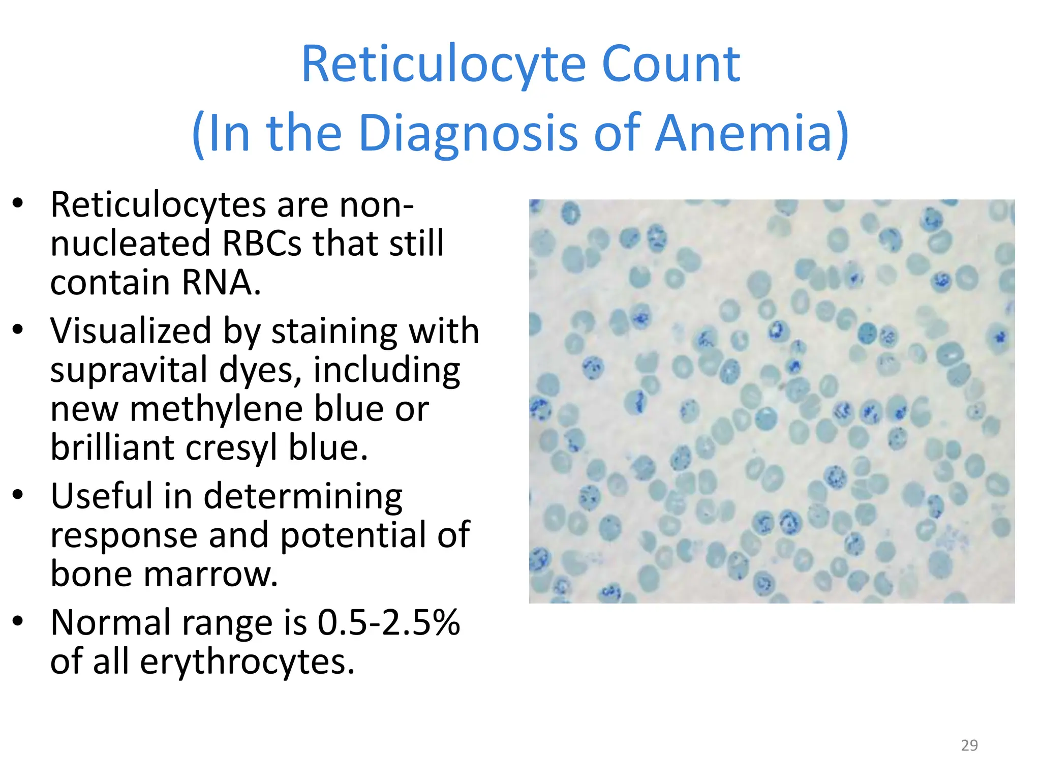 Anemia up to date classification and diagnosis .pptx