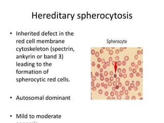 Anemia up to date classification and diagnosis .pptx