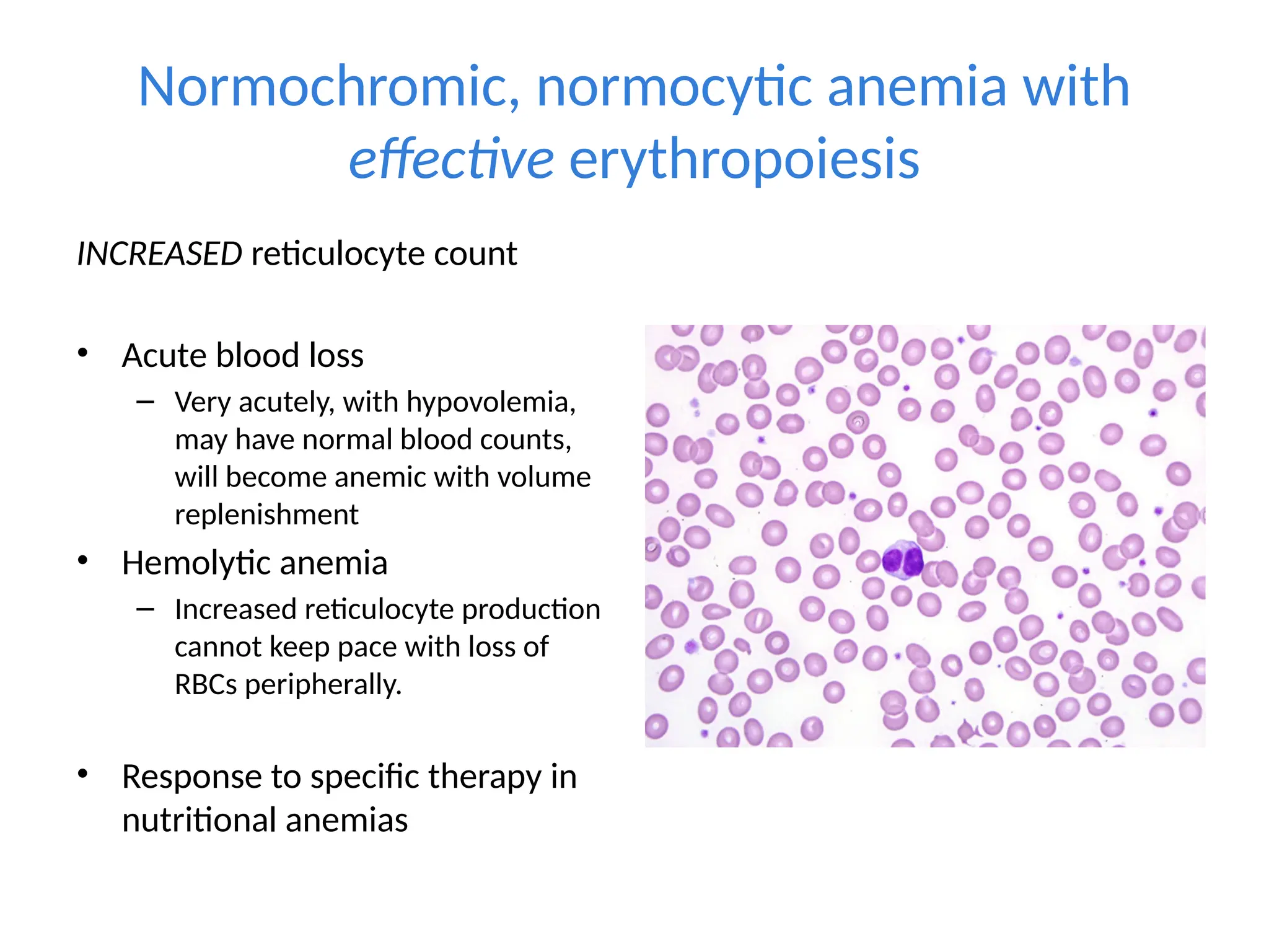 Anemia update diagnosis and management .pptx