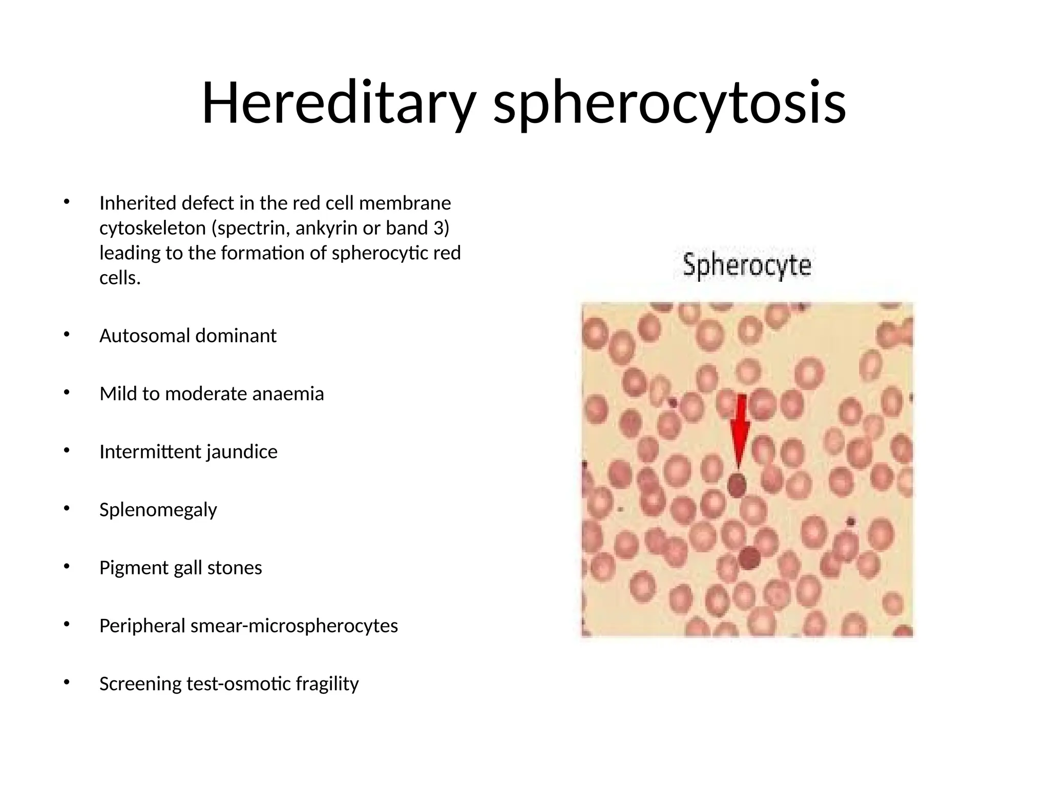 Anemia update diagnosis and management .pptx