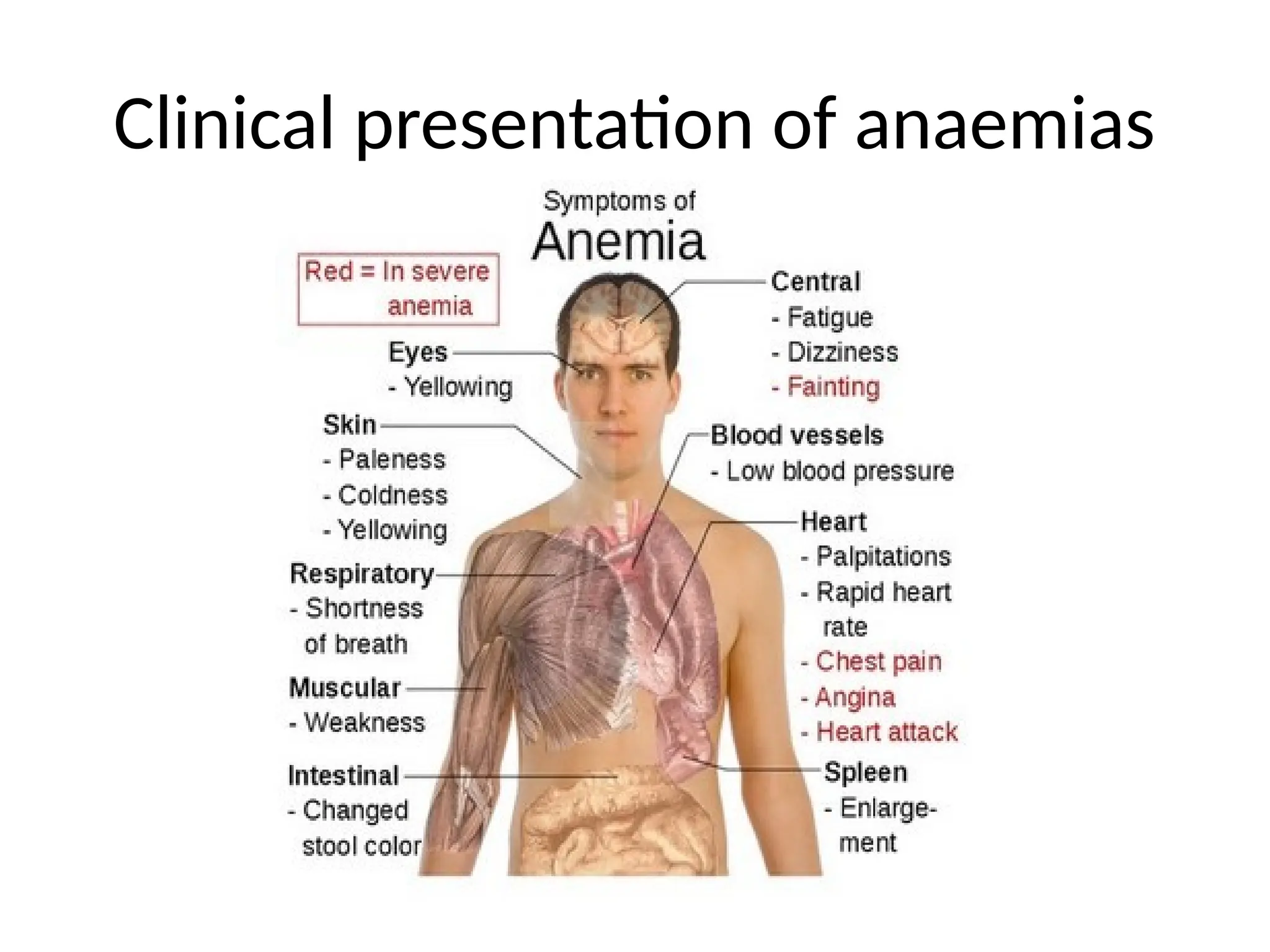 Anemia update diagnosis and management .pptx