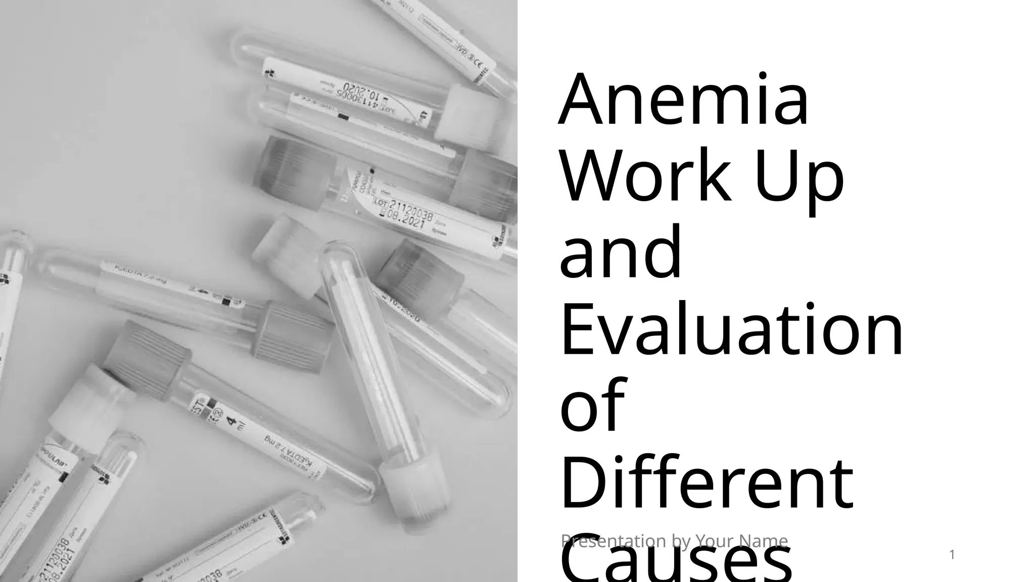 Anemia Work Up and Evaluation of Different Causes.pptx