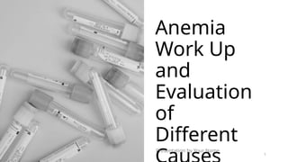 Anemia Work Up and Evaluation of Different Causes.pptx